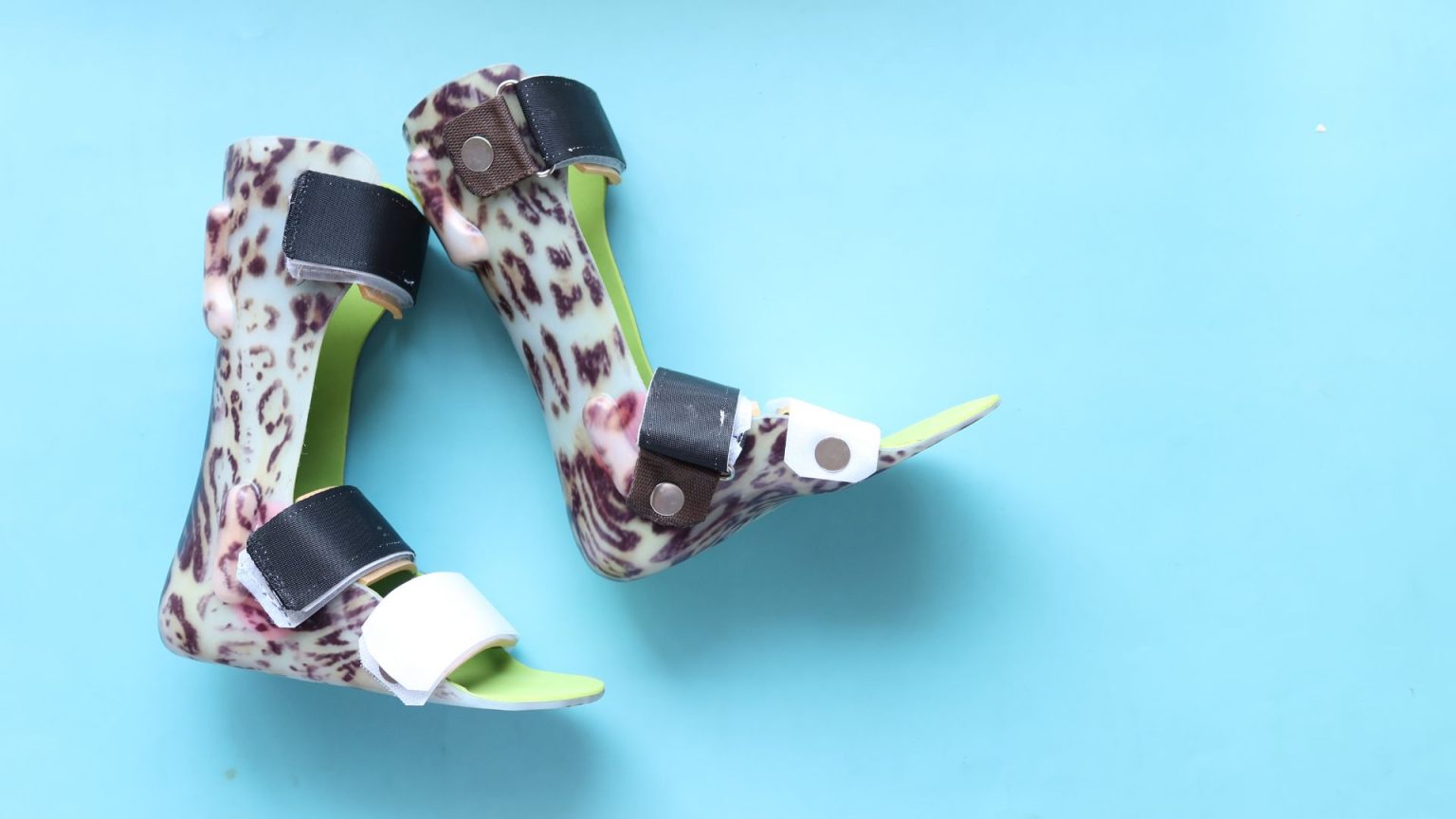 Czym są ortezy i kiedy warto je stosować? - Inovamed